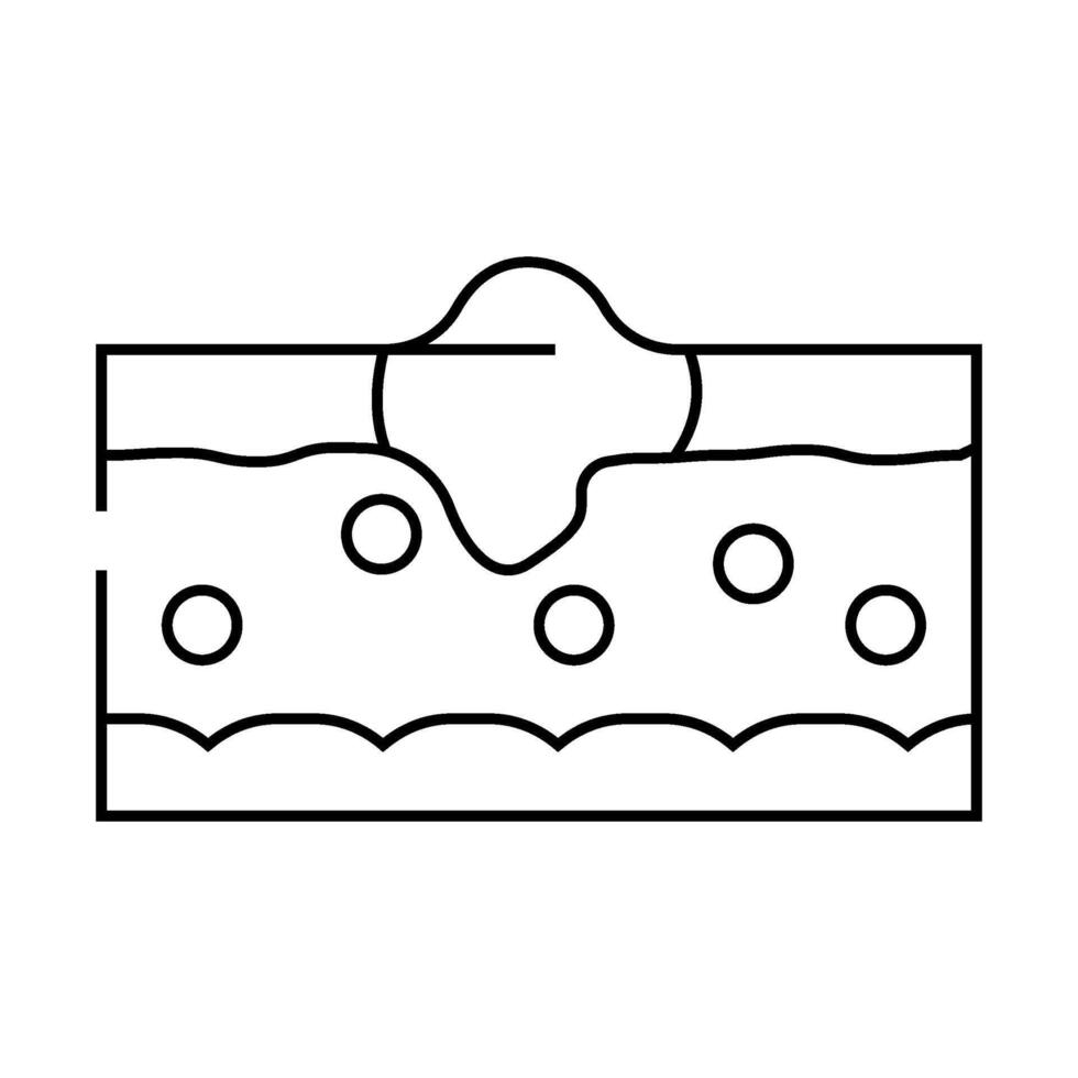 Abstract Problem Skin Disease Line Icon Illustration 48350659 Vector Art At Vecteezy