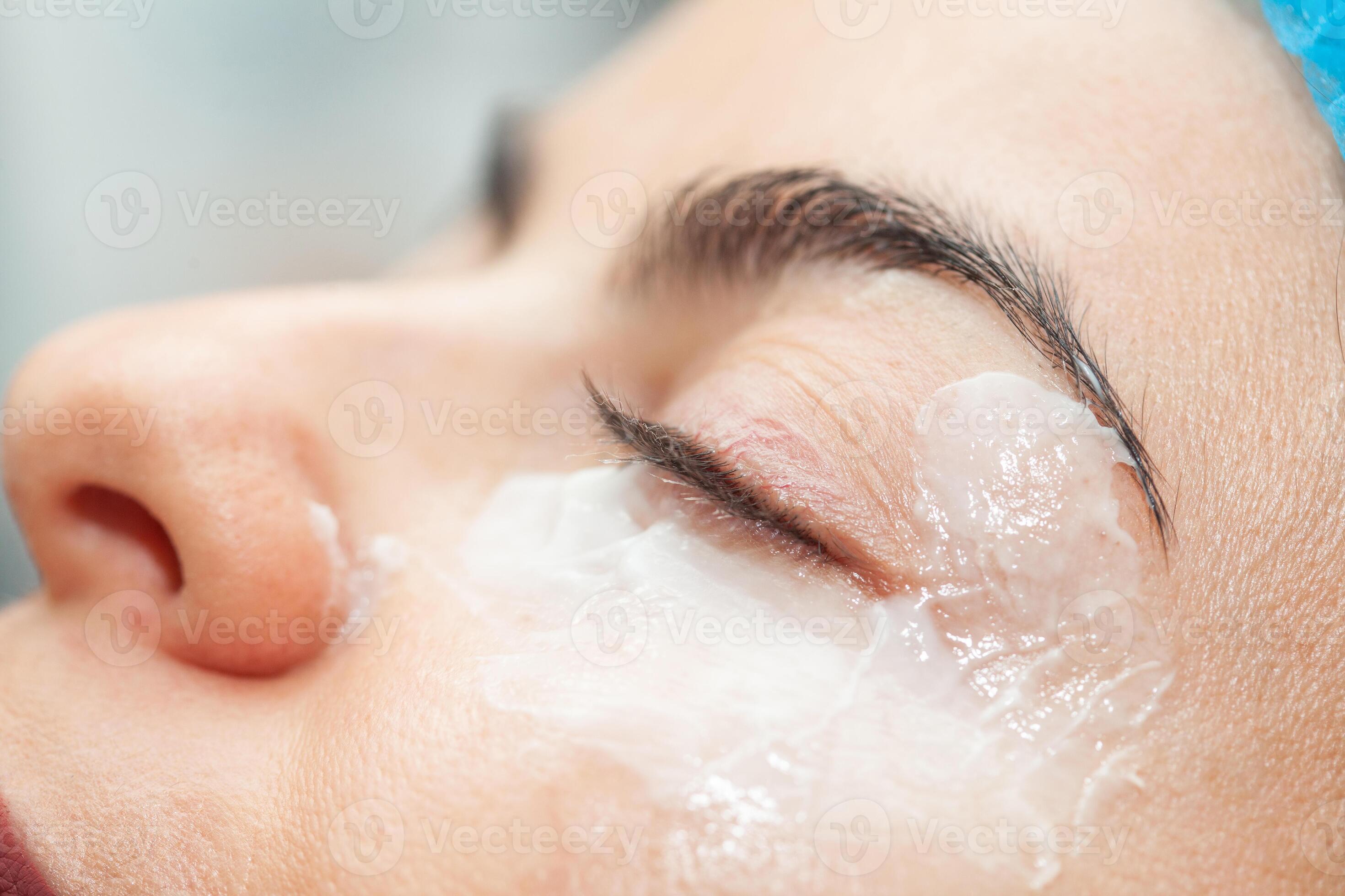 Application of topical anesthesia cream prior to a dermatological ... Application of topical anesthesia cream prior to a dermatological ...