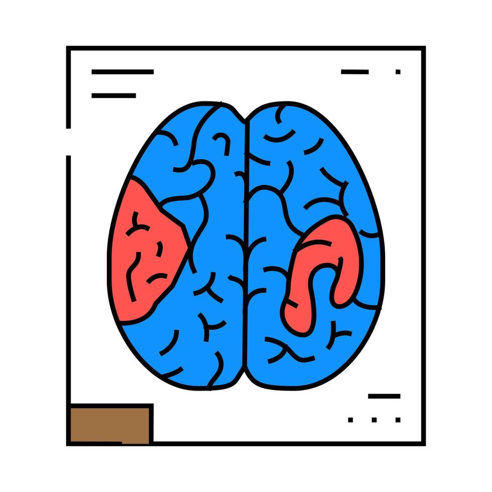 functional mri neuroscience neurology icon color illustration 49828988 ... functional mri neuroscience neurology icon color illustration 49828988 ...