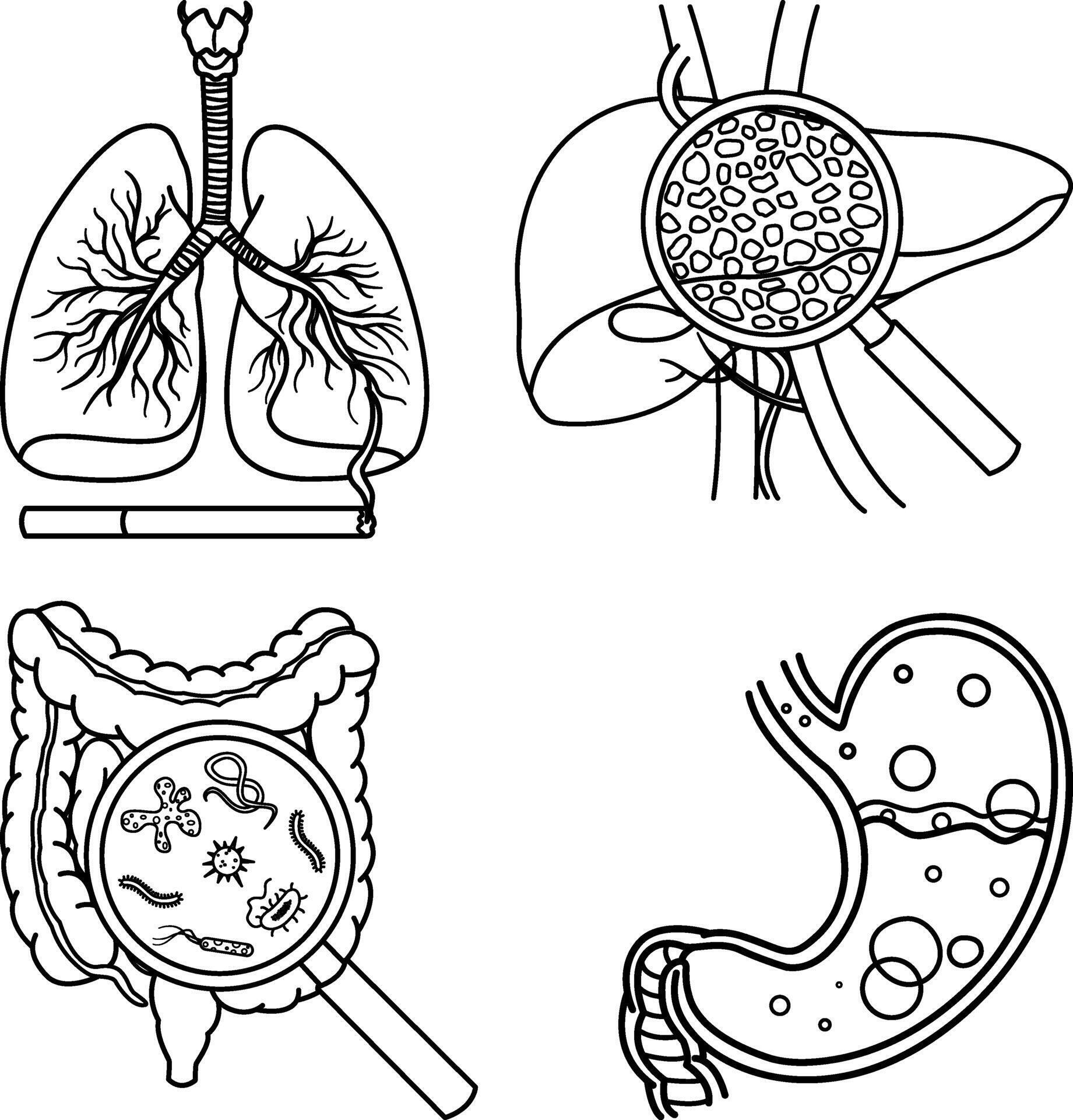 Anatomy of Human Organs with Various Diseases for Coloring ...