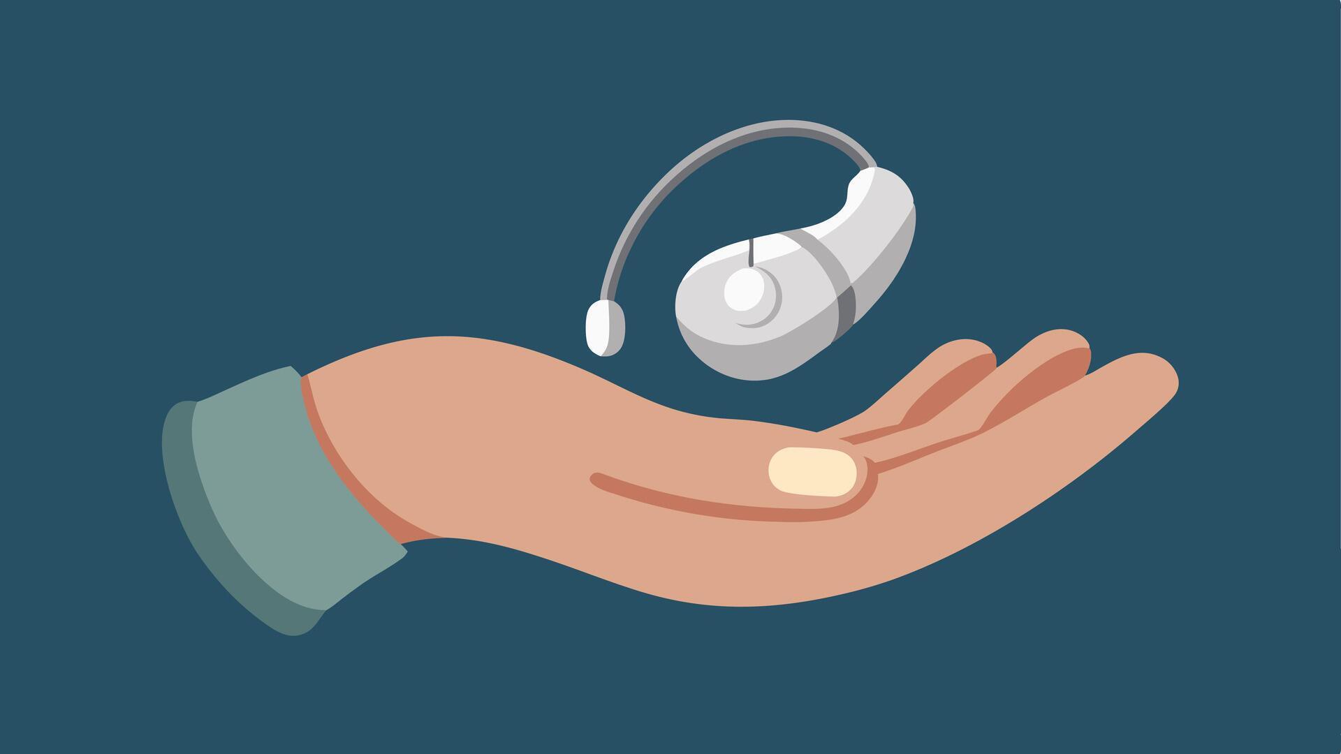 Cochlear Implant Diagram An educational illustration featuring the ...