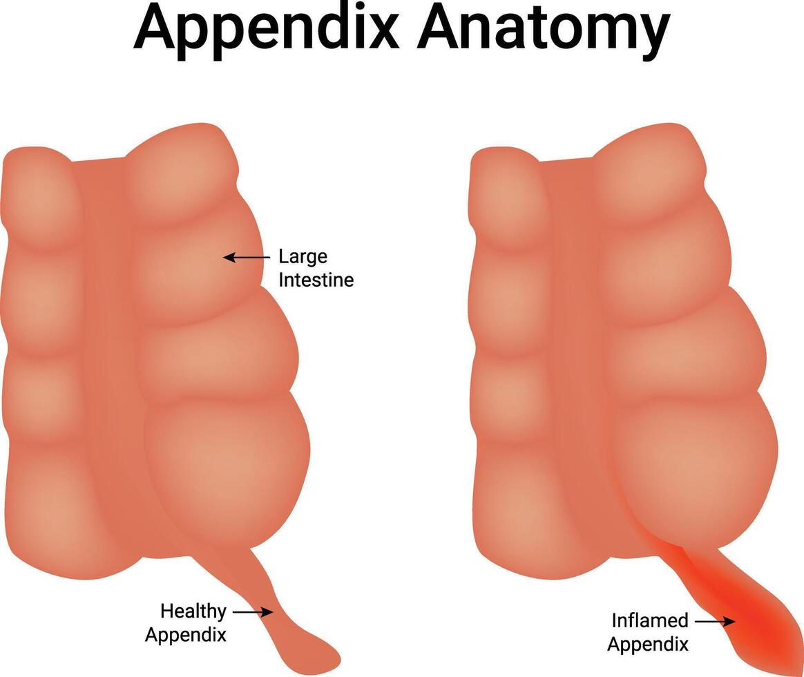 Appendix Diagram Vector Art, Icons, and Graphics for Free Download