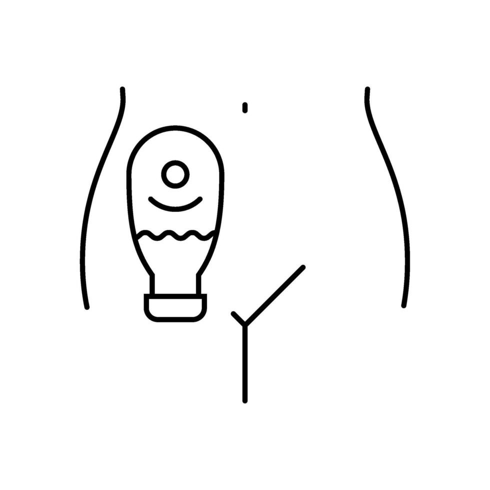 Ostomy Surgery Hospital Line Icon Illustration 52844116 Vector Art At Vecteezy