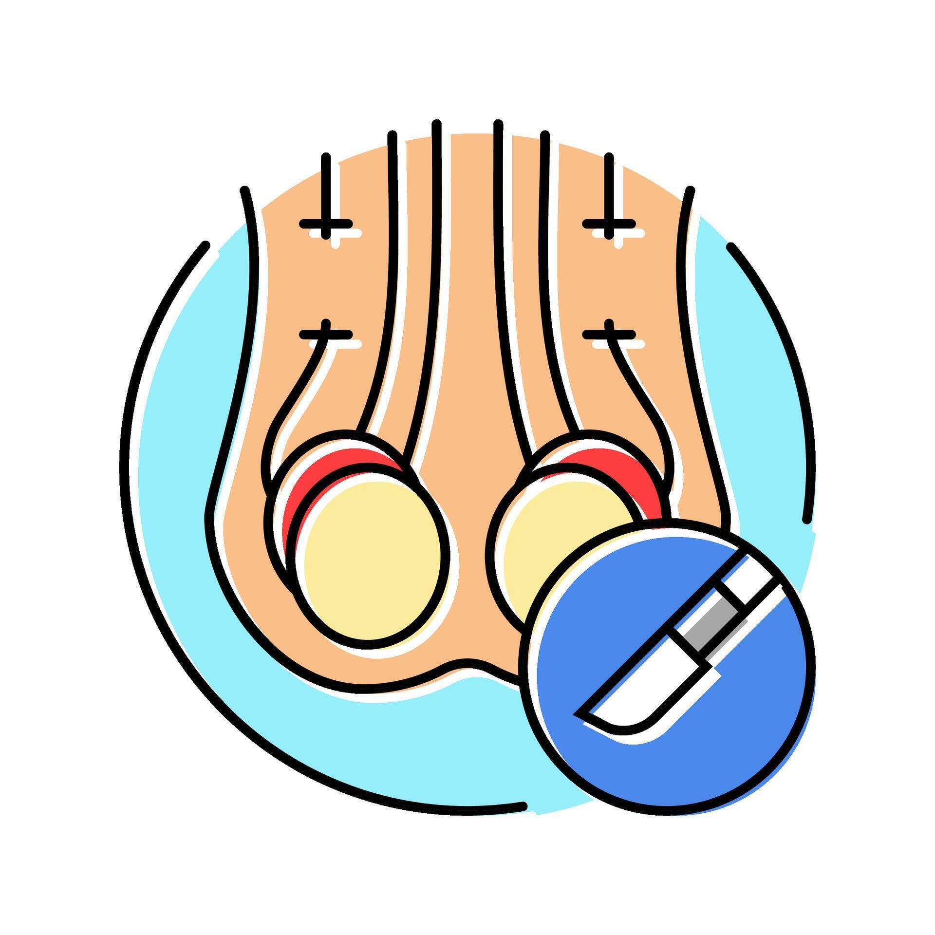 vasectomy surgery color icon illustration 52844283 Vector Art at Vecteezy vasectomy surgery color icon illustration 52844283 Vector Art at Vecteezy
