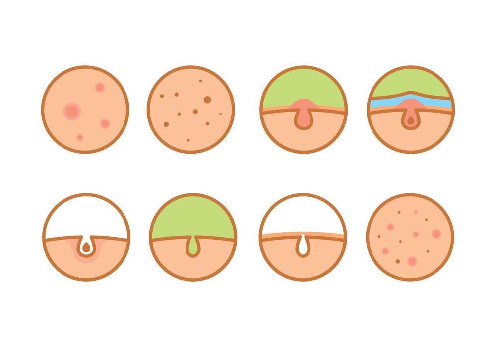 Genital Warts Vector Art, Icons, and Graphics for Free Download