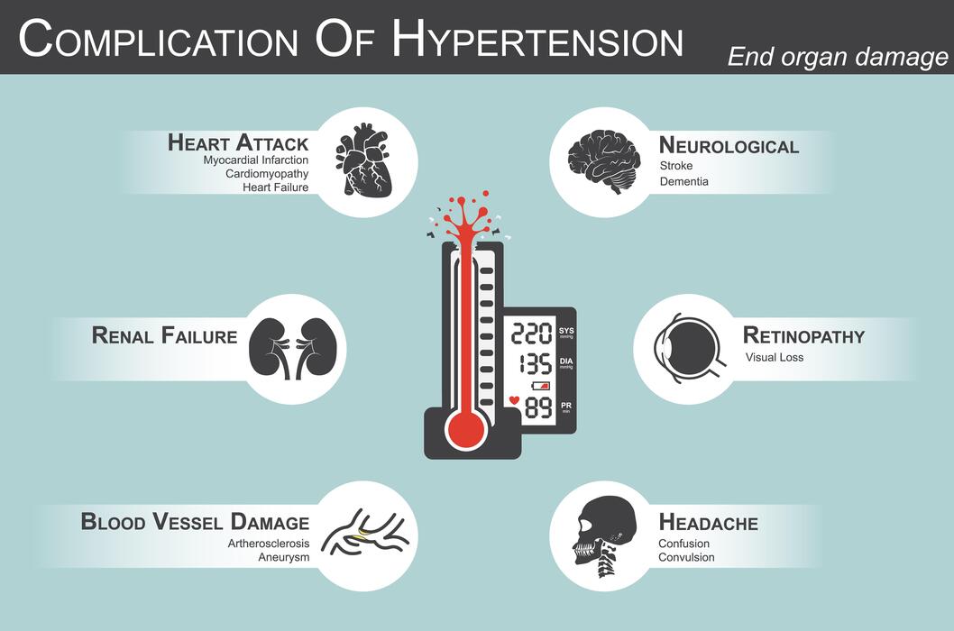 Myocardial Infarction Vector Art, Icons, and Graphics for Free Download