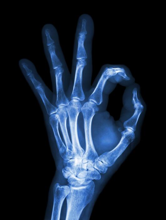X Ray Hand Stock Photos, Images and Backgrounds for Free Download