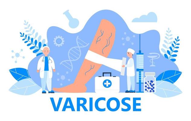 Varicose Veins Vector Art, Icons, and Graphics for Free Download Varicose Veins Vector Art, Icons, and Graphics for Free Download