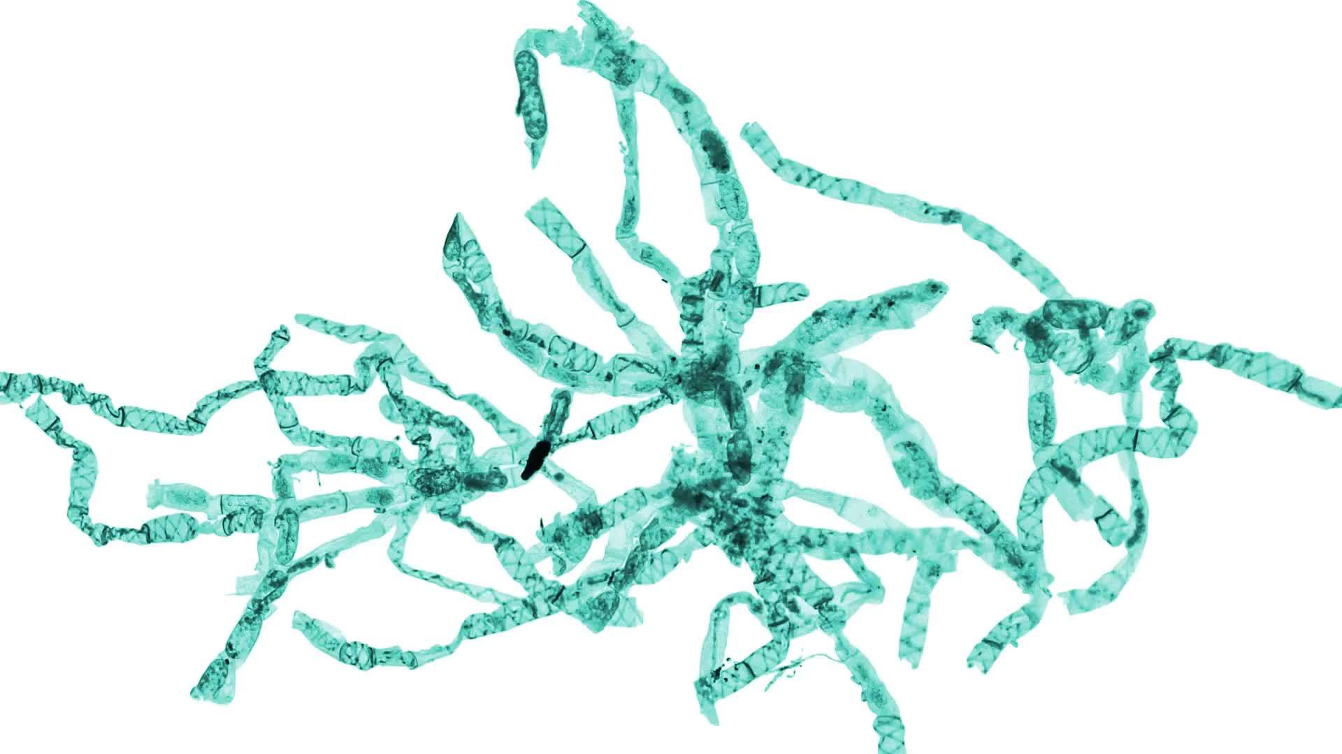 Spirogyra light micrograph 11393053 Stock Video at Vecteezy Spirogyra light micrograph 11393053 Stock Video at Vecteezy