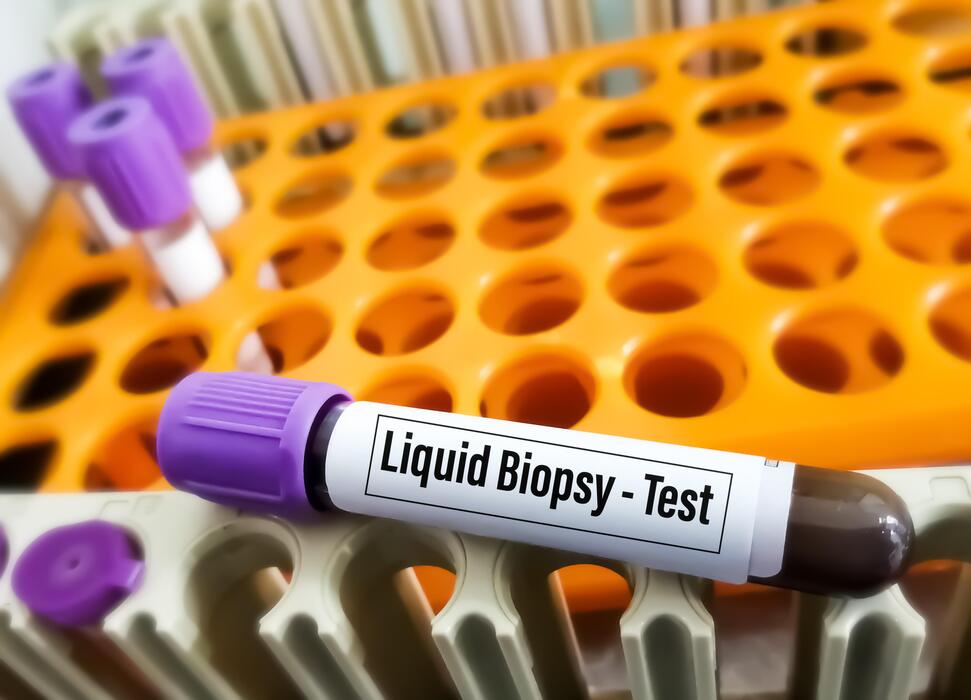 Liquid Biopsy Stock Photos, Images and Backgrounds for Free Download