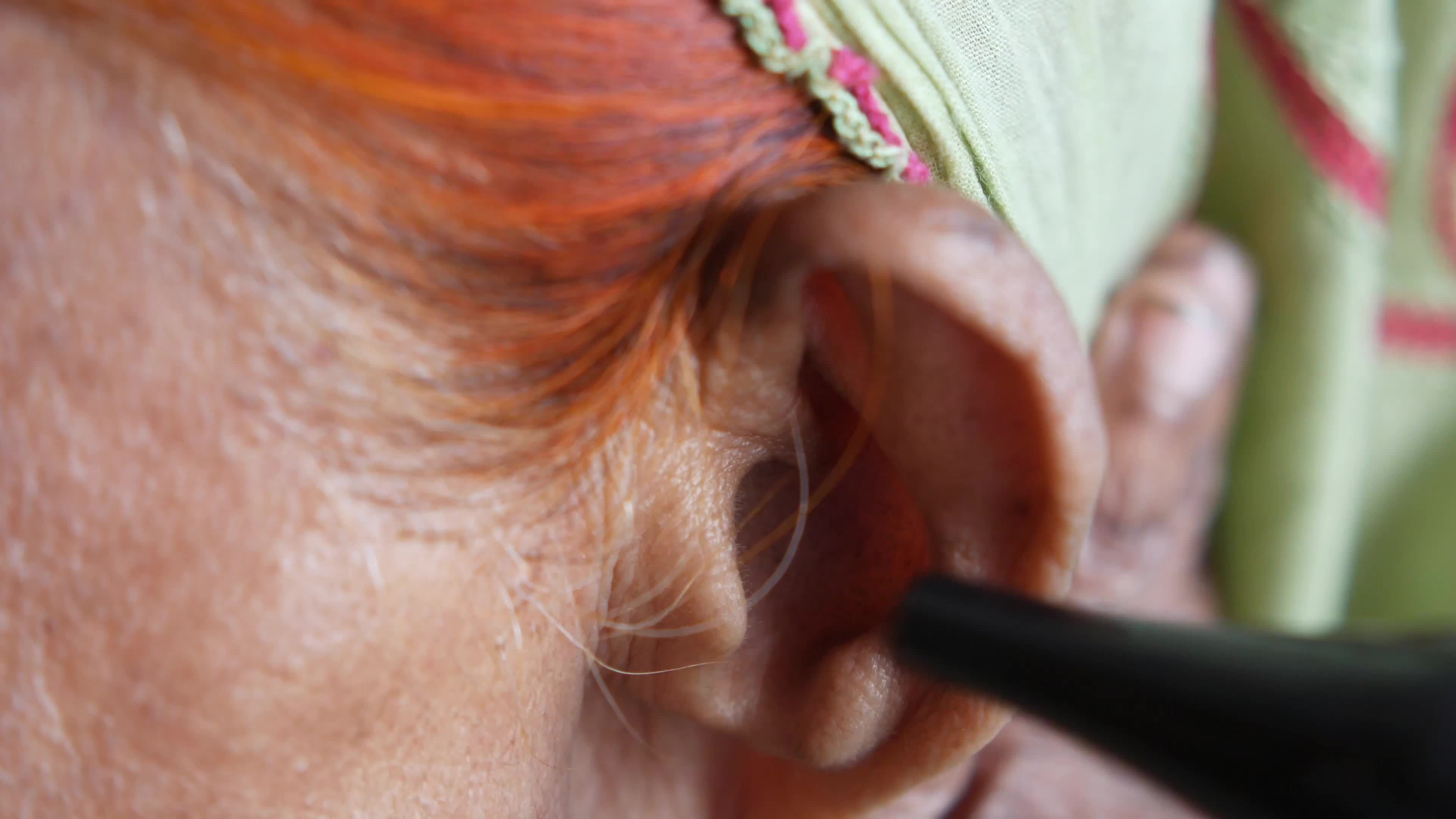 Examining Senior Patient Ear By Otoscope Close Up 21041152 Stock Video At Vecteezy