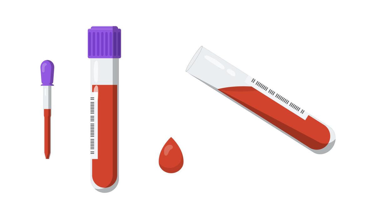Blood Sample Vector Art, Icons, and Graphics for Free Download