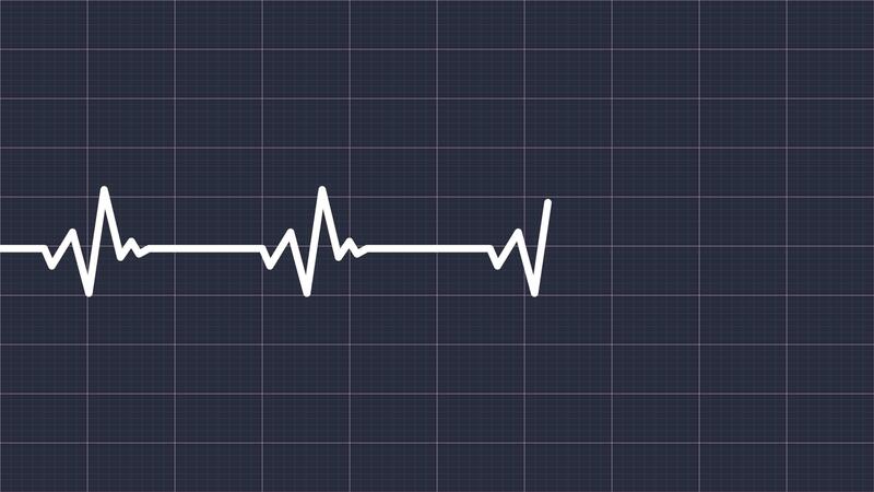 Heartbeat Pulse Rate animation with grid Background. Electrocardiogram beeping trace in Heart ...