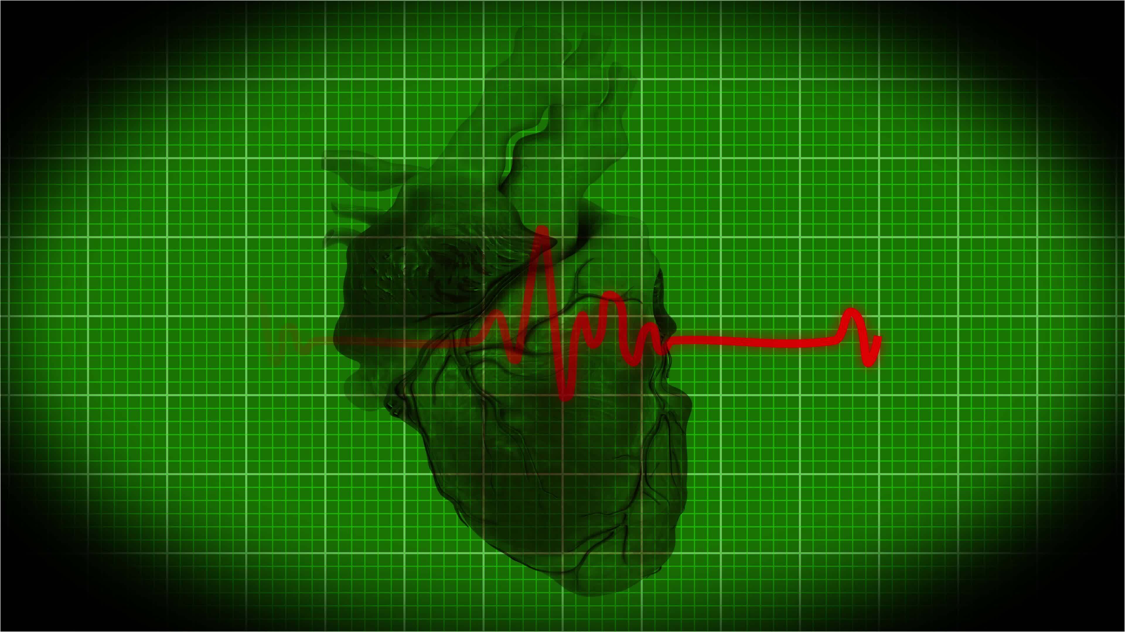 heart beat pulse line displaying in cardiograph monitor 25890345 Stock ... heart beat pulse line displaying in cardiograph monitor 25890345 Stock ...