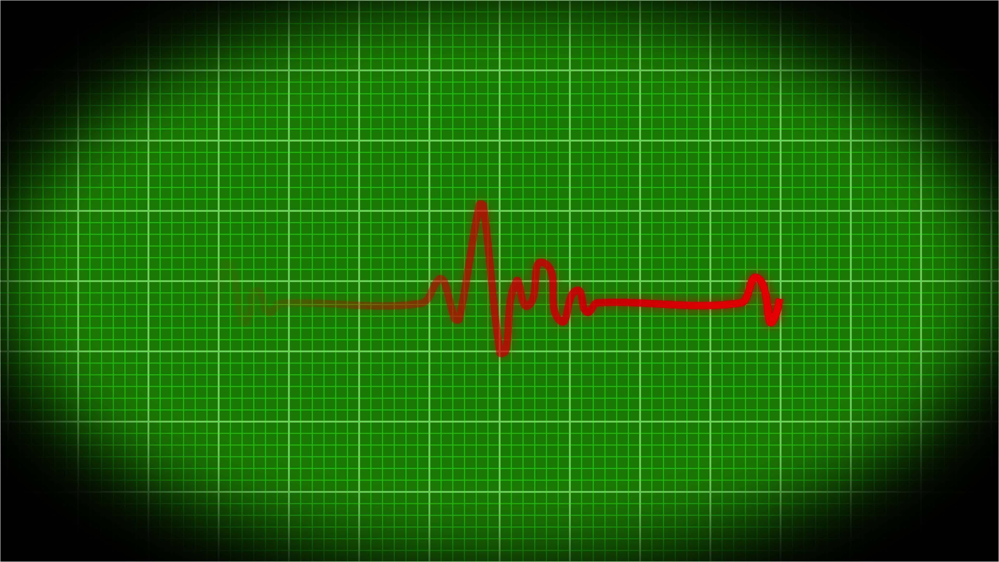 heart beat pulse line displaying in cardiograph monitor 25891164 Stock ... heart beat pulse line displaying in cardiograph monitor 25891164 Stock ...