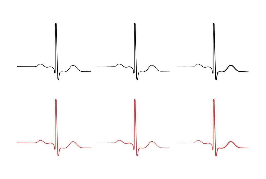 Heart Ecg Vector Art, Icons, and Graphics for Free Download