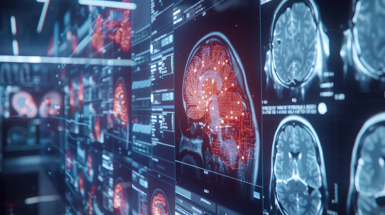 Neurology Background Stock Photos, Images and Backgrounds for Free Download