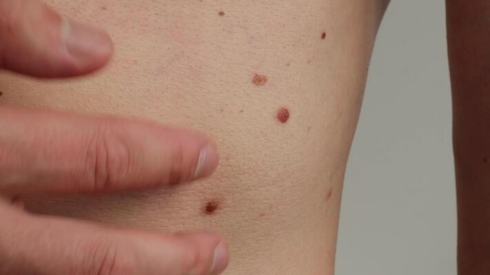 Skin Layer Stock Video Footage for Free Download Skin Layer Stock Video Footage for Free Download