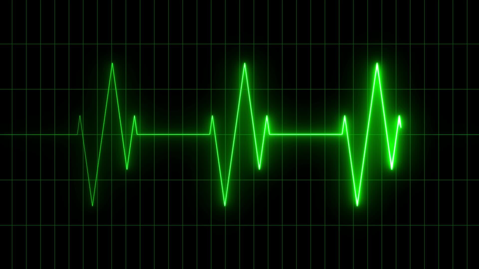 Heart Rate Monitor Pulse Rate Motion Loop background 44258398 Stock Video at Vecteezy