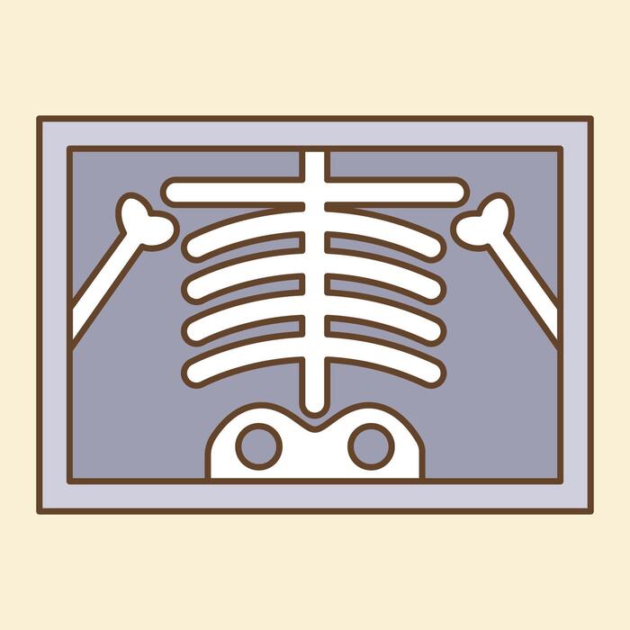 X Ray Cartoon Vector Art, Icons, and Graphics for Free Download