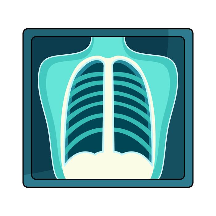 X Ray Cartoon Vector Art, Icons, and Graphics for Free Download