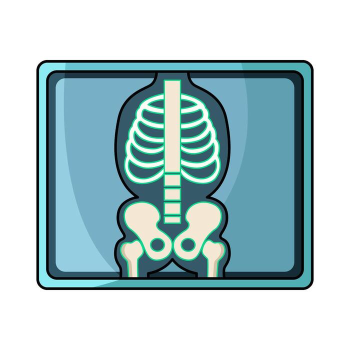 X Ray Cartoon Vector Art, Icons, and Graphics for Free Download